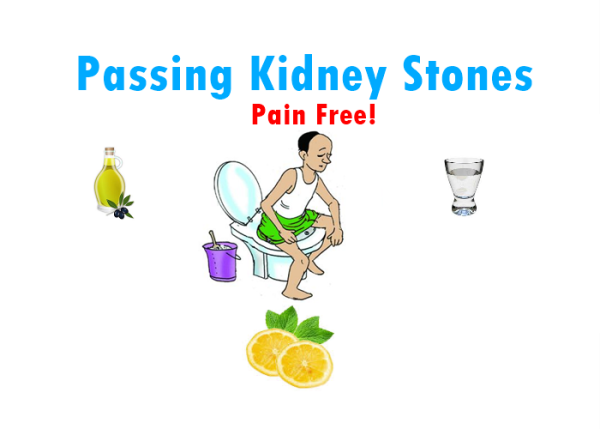 How To Prevent and Remove Kidney Stones Naturally